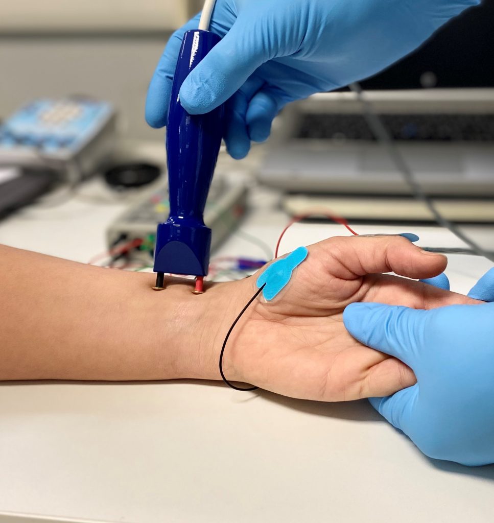 Nerve Conduction Studies - Spes Medica